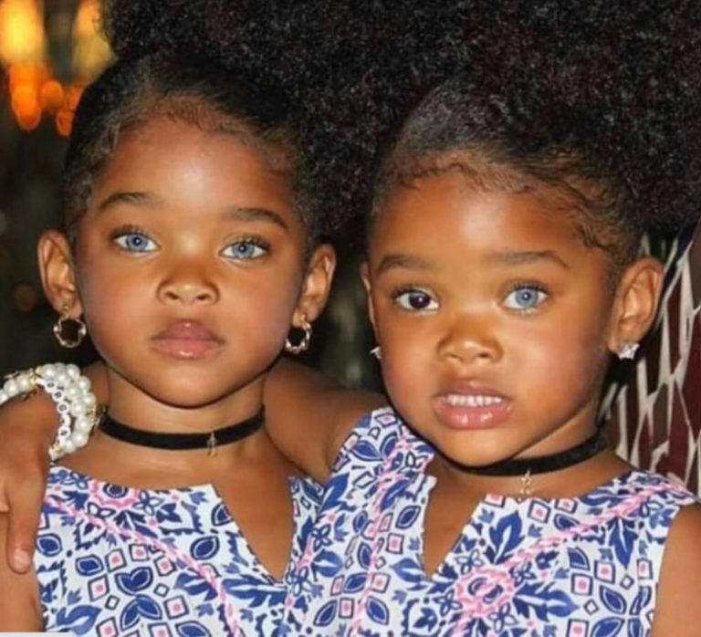 Twin sisters who amazed the world with their extraordinary beauty